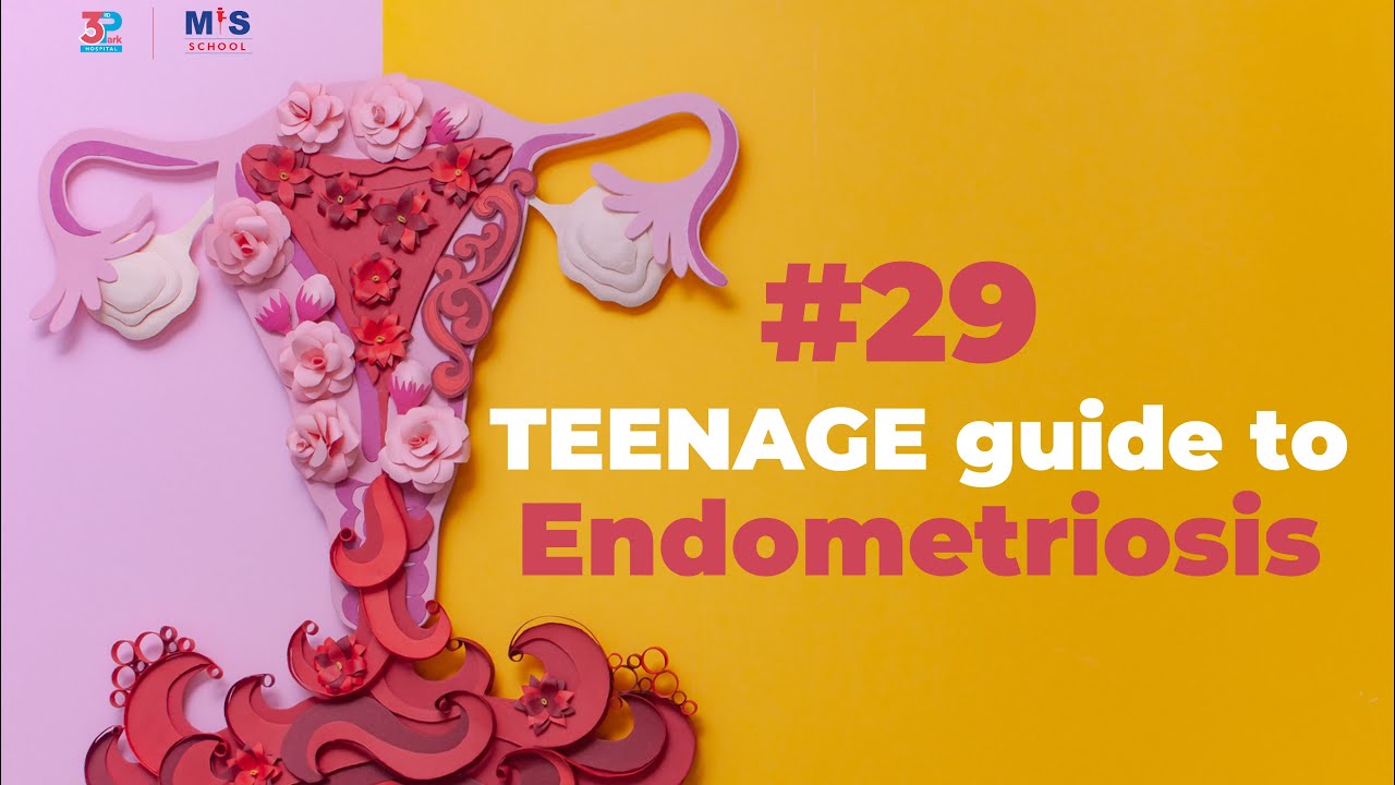 Teenage guide to Endometriosis - YouTube