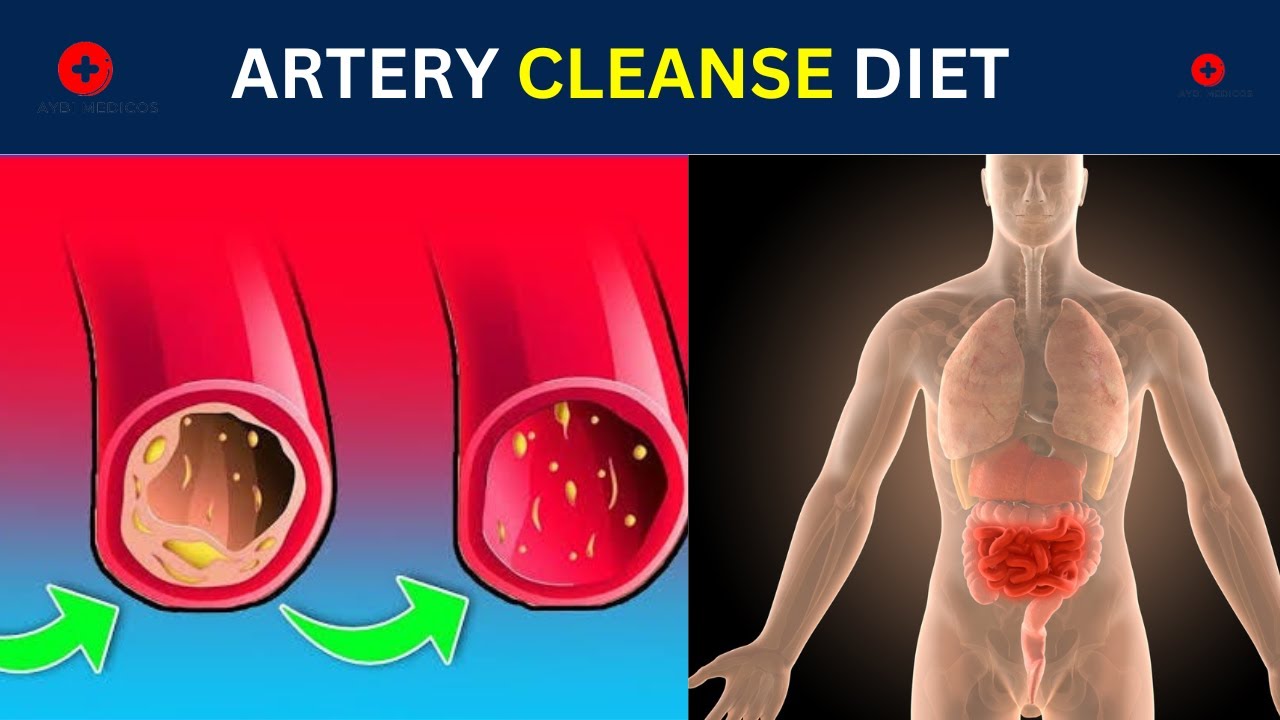 Artery Cleanse Diet (Clear Your Arteries with These Nutritious Foods ...