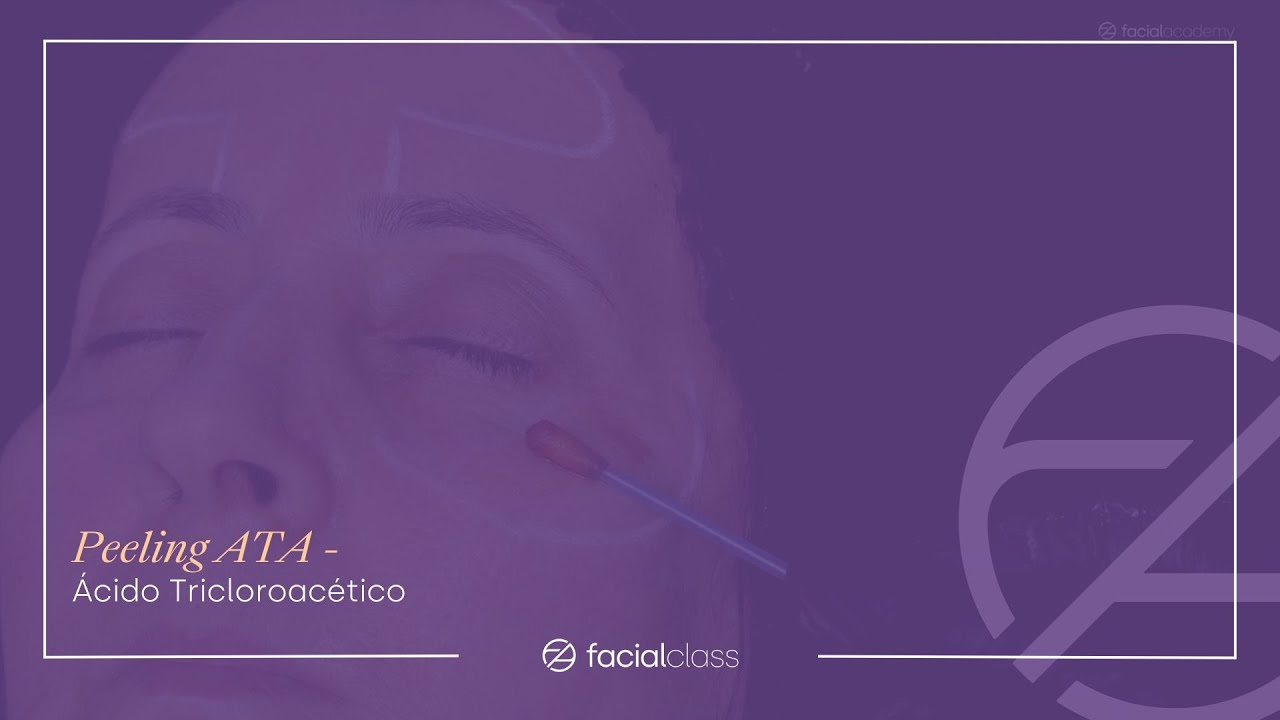 Peeling de ATA - Ácido Tricloroacético | Facial Class - YouTube