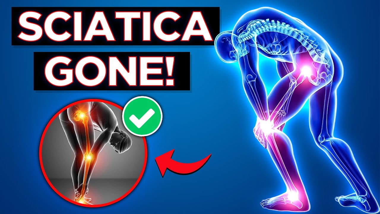 Fix Your Sciatica: 3 Diagnostic Tests and 3 Exercises for Pain Relief ...