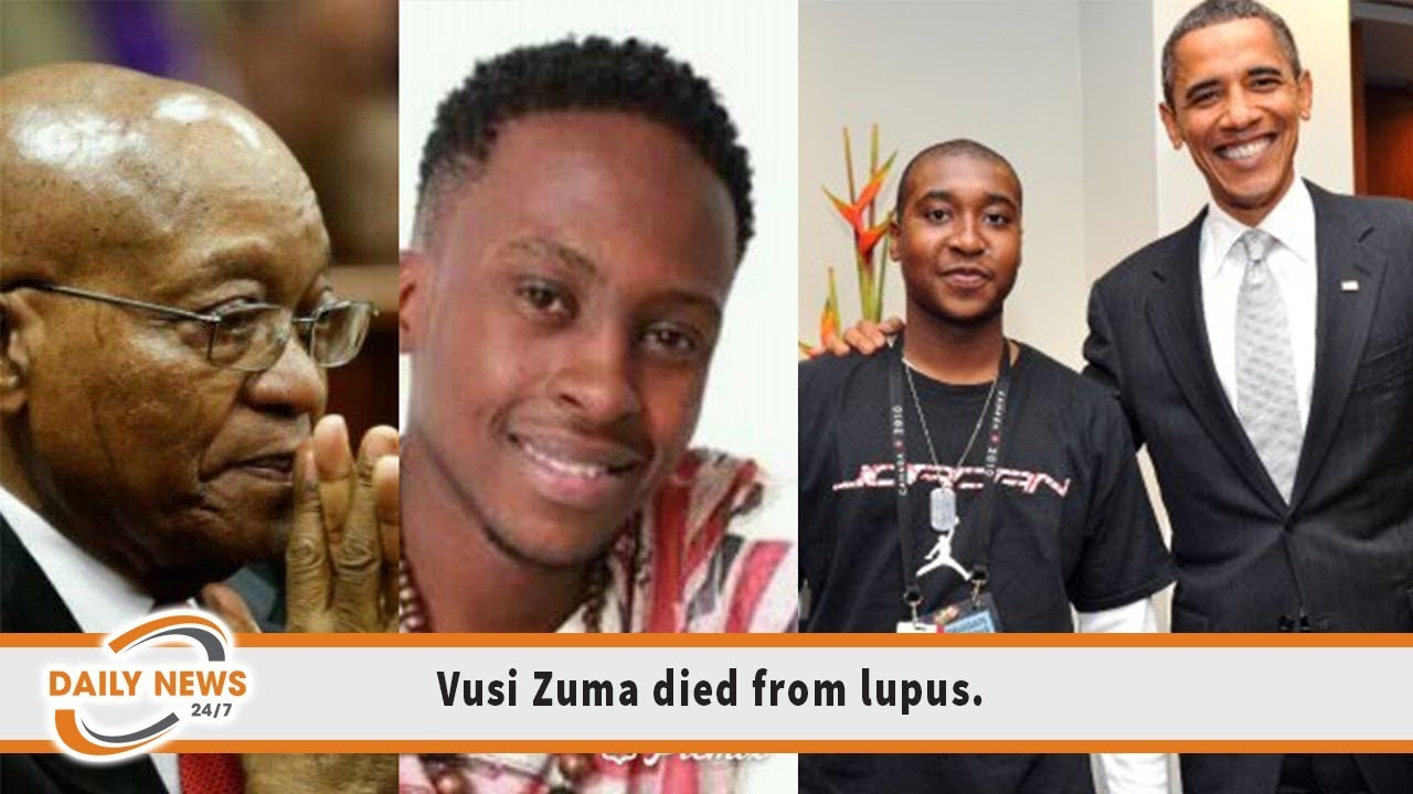 Vusi Zuma (Jacob Zuma's son) died from lupus - YouTube