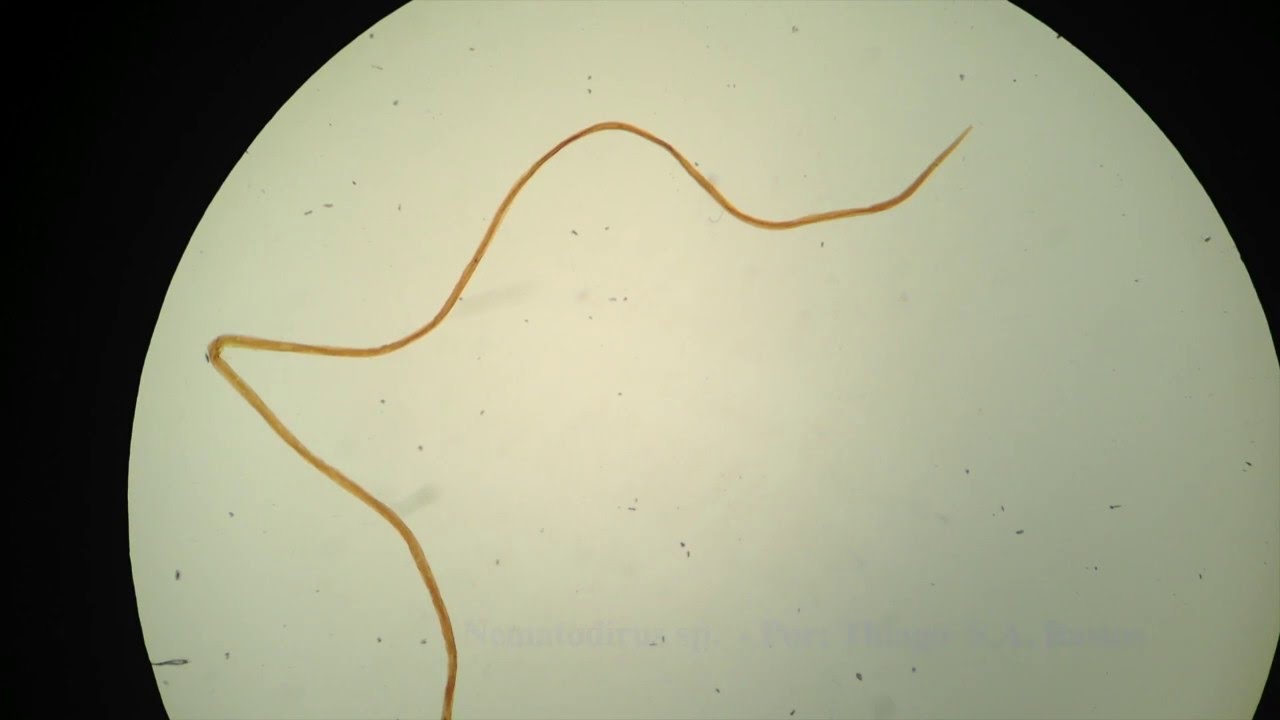 Nematodirus sp. - YouTube
