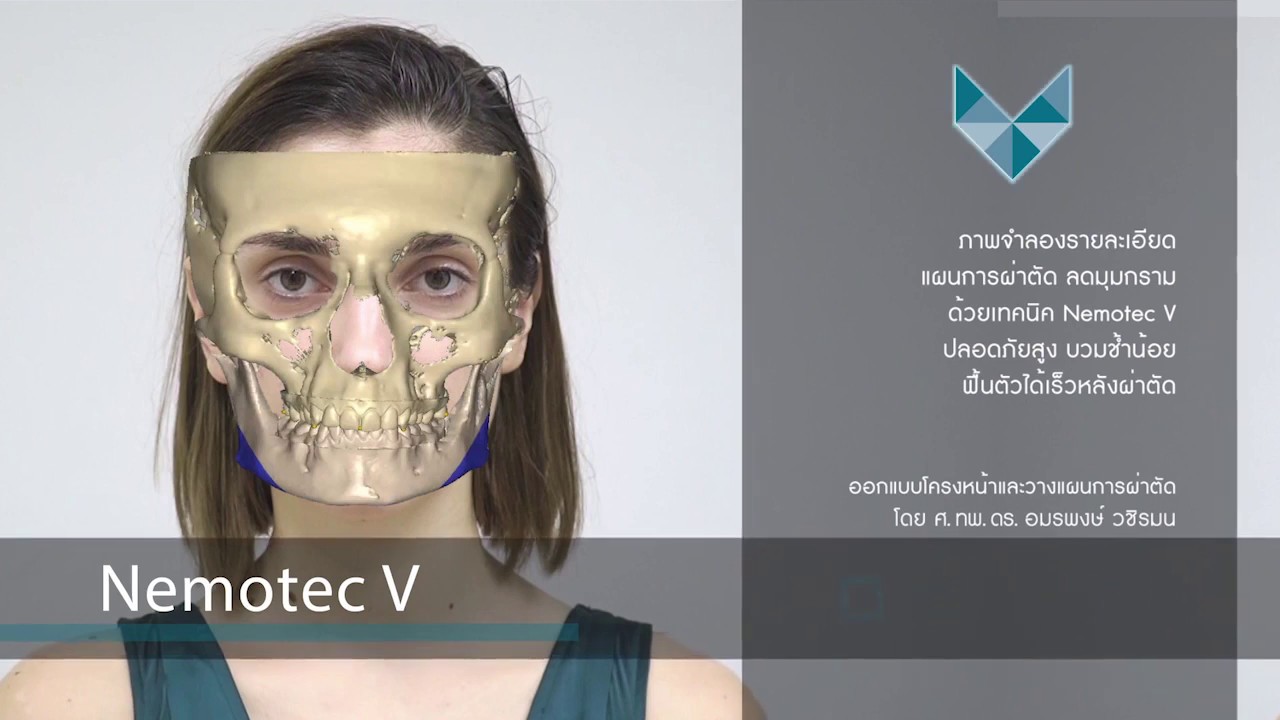 Model Slovakian plastická operácia/plastic surgery2 - YouTube