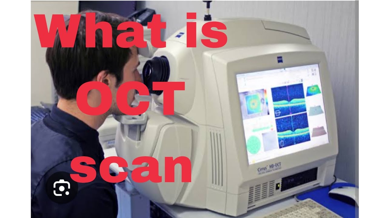 What is OCT scan??? Importance of OCT scan - YouTube