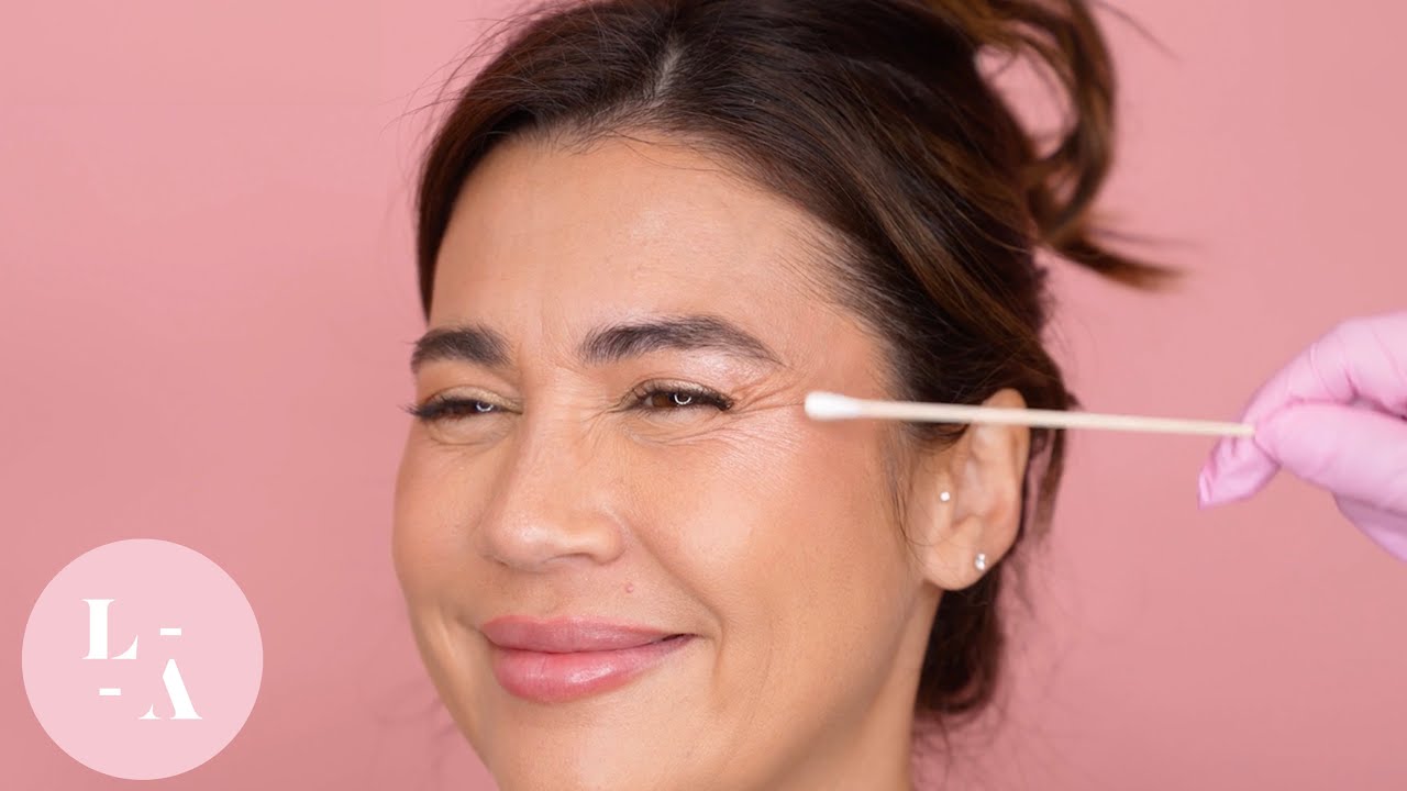 Come See What A Botox Consult Looks Like - YouTube