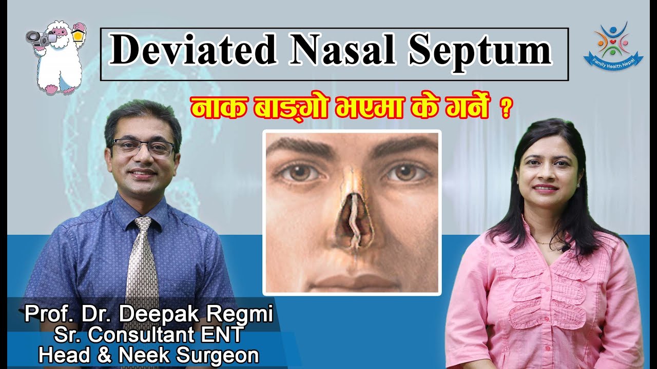 Episode:120 Deviated Nasal Septum (नाक बाङ्गो भएमा के गर्ने ?) Prof. Dr ...