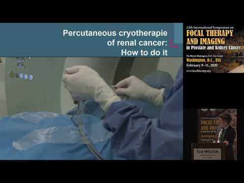 9 Jochen Walz France Cryoablation of renal masses and outcome in pT1b ...