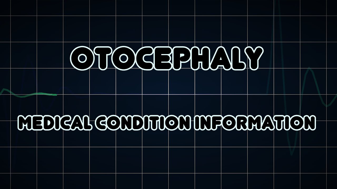 Otocephaly (Medical Condition) - YouTube