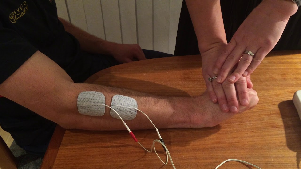 9 FES setting threshold and intensity - YouTube