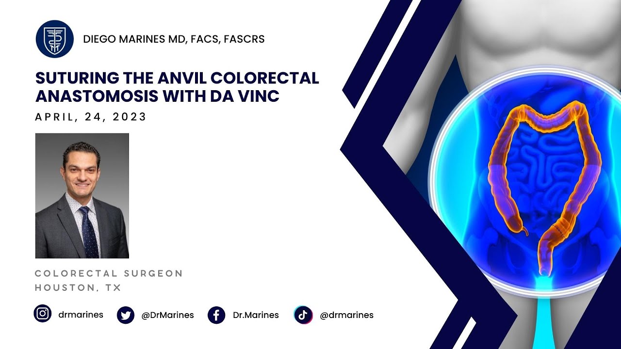 Suturing the Anvil - YouTube