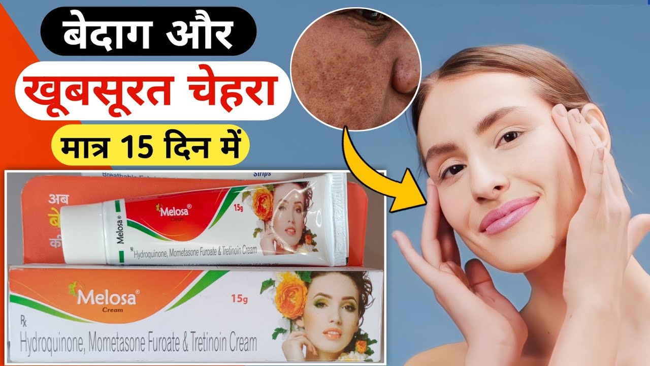 Melosa Cream Review | गोरा होने वाला क्रीम | Gora Hone Wala Cream - YouTube