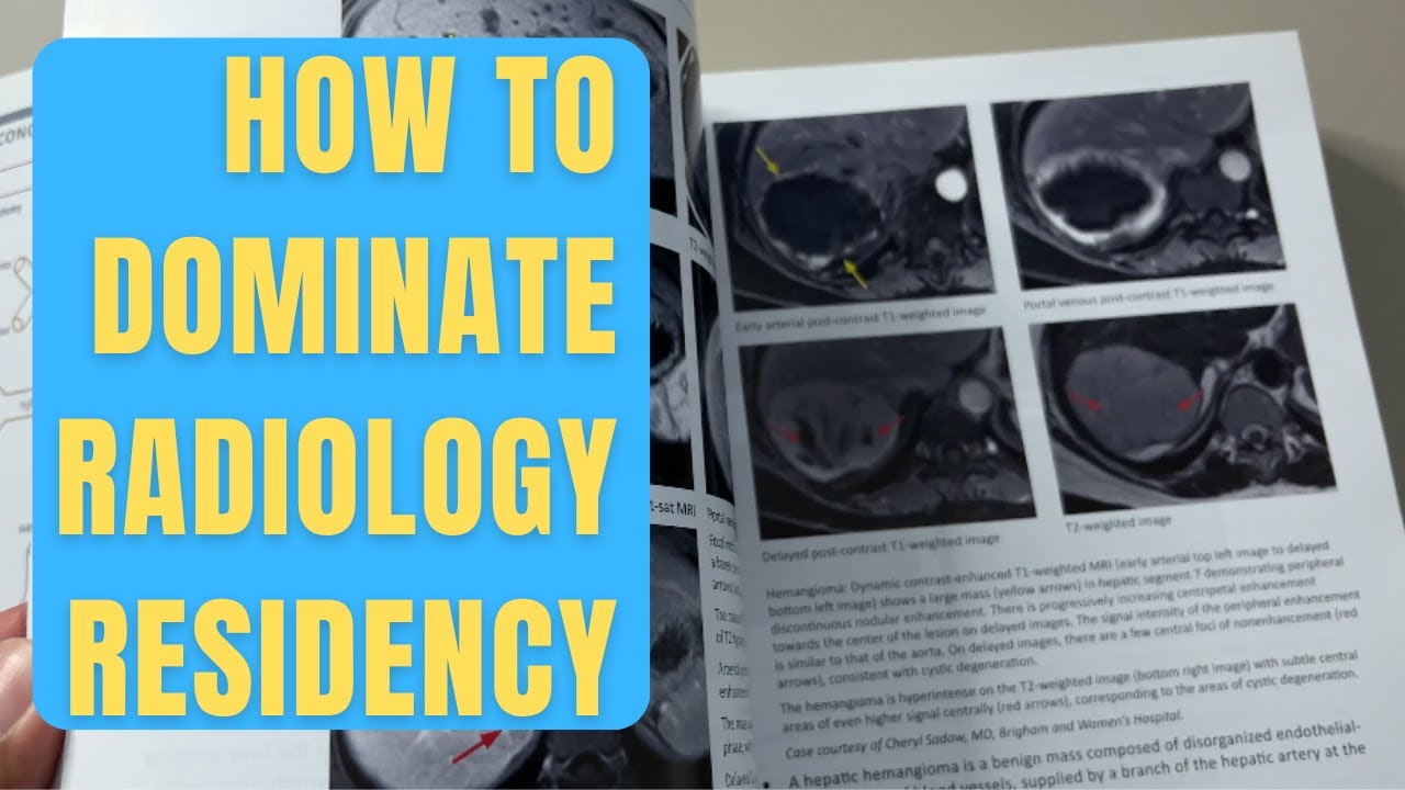 Radiology Residency - Tips and Tricks - YouTube
