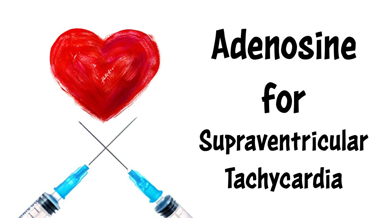 Adenosine for Supraventricular Tachycardia (SVT), A Basic Tutorial ...