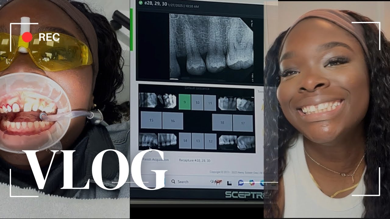 VLOG: Teeth REVEAL had me crying hysterically. Y’all will NOT believe ...