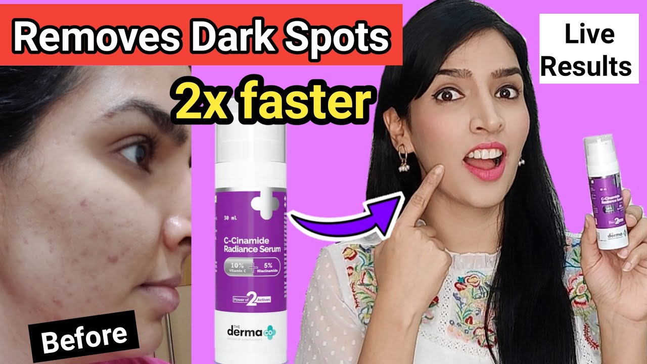 Derma co C Cinamide Radiance Serum Review | Serum for Dark spots ...