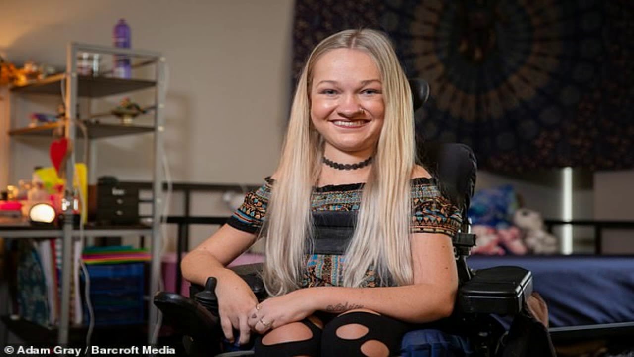 Alex Dacy dubbed 'Wheelchair Rapunzel' who was born with spinal ...