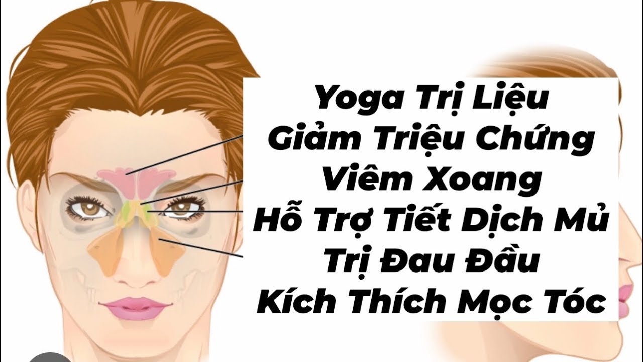 Yoga Trị Liệu: Trị Viêm Xoang, Tăng Tiết Dịch Mủ Từ Các Xoang, Trị Đau ...