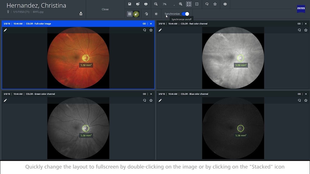How to use Advanced Review tools of ZEISS FORUM 4.4. - YouTube