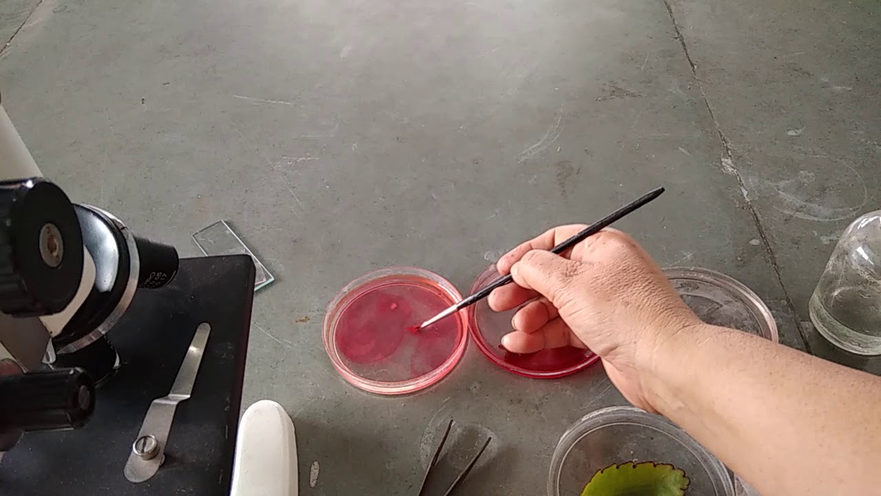 Class X bio. Activity to prepare temporary mount of epidermal peel to ...