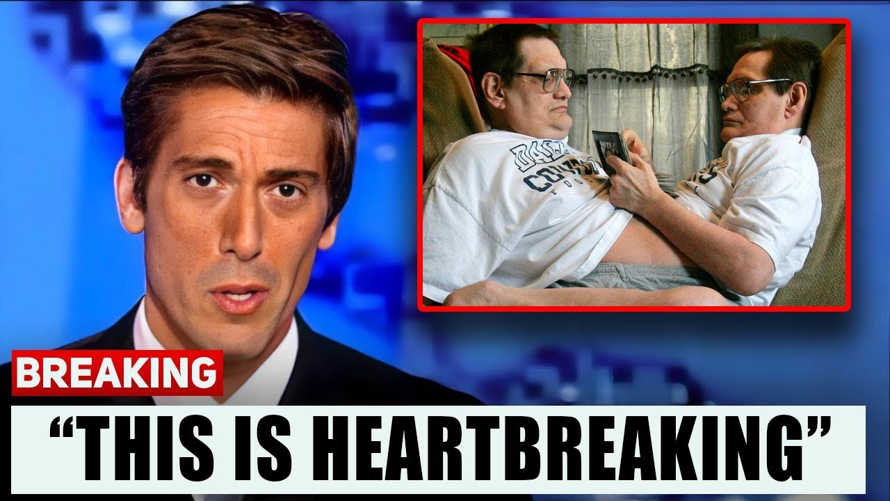 Conjoined Twins Ronnie and Donnie Galyon Pass Away at 68 - YouTube