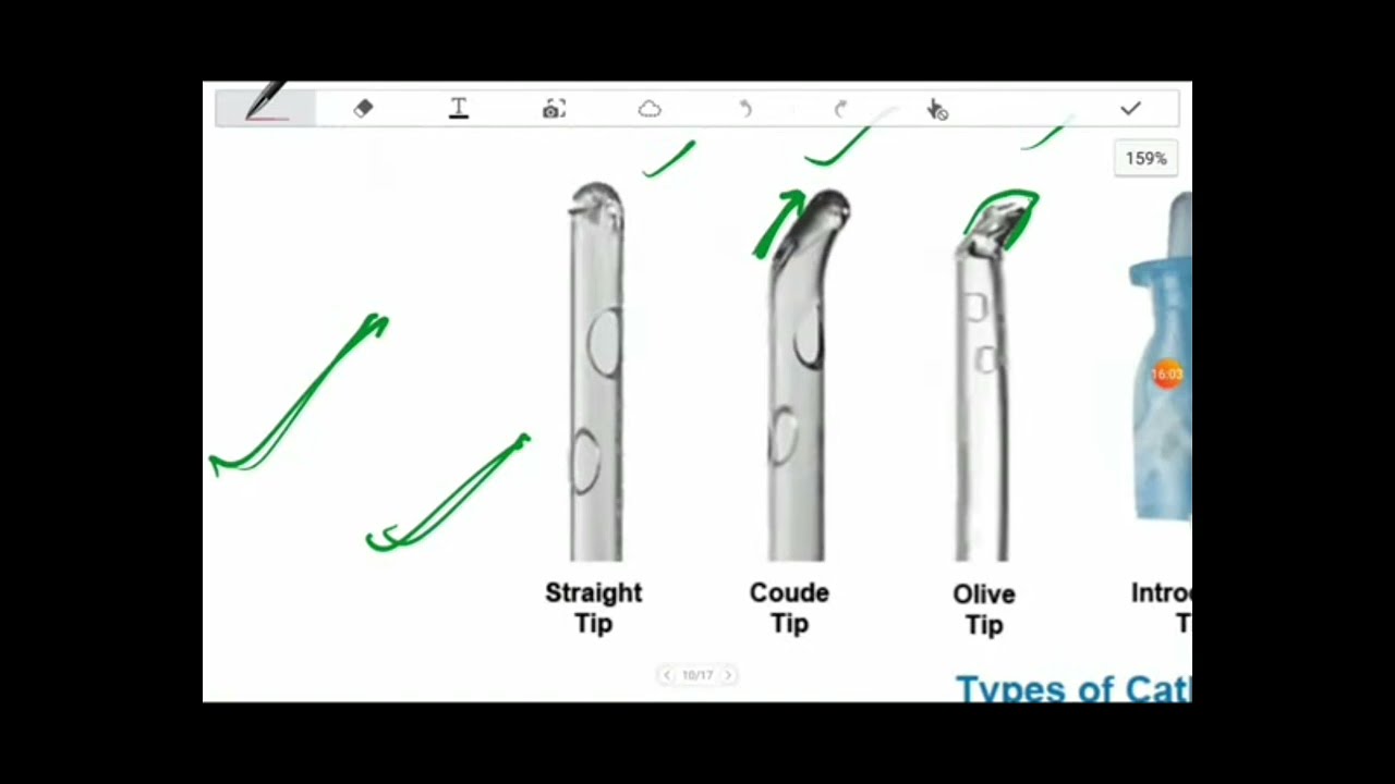 Urinary catheter/size I colour coding/FAQS/tricks/mnemonics👍 ️😃 - YouTube