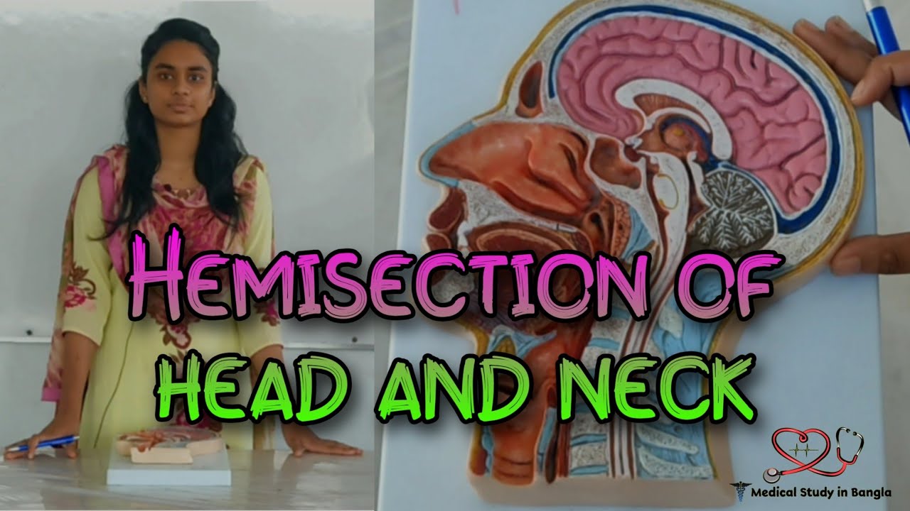 Hemisection of head-neck in Bangla || Medical study in Bangla - YouTube