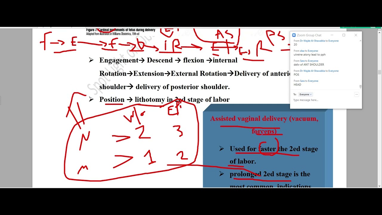 Obs&Gyne Review Obstetric Antrapartum 3 Normal labour B +Fetal ...