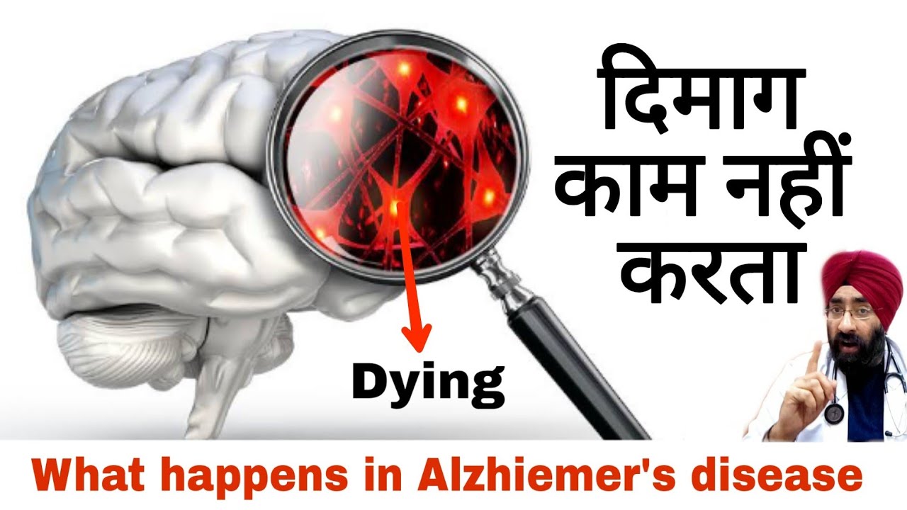 When Brain stops working | Understand Alzheimer's Disease | मनोभ्रंश ...