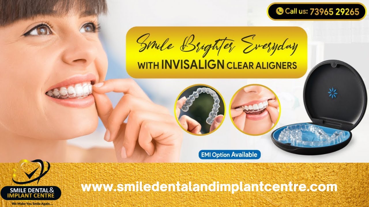 Smile Brighter Everyday with Invisalign Clear Aligners - YouTube