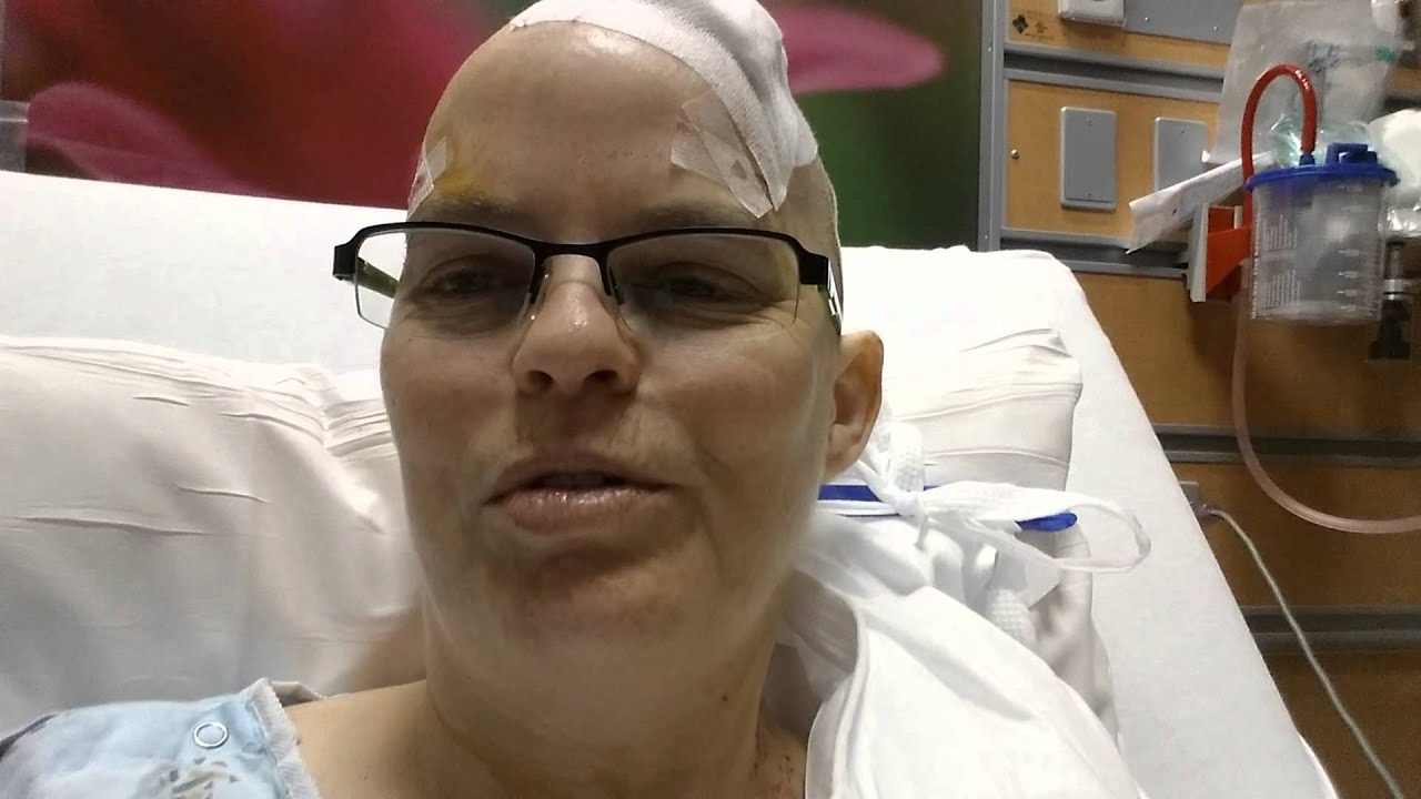 Essential tremor, the day of the #DBS surgery - YouTube