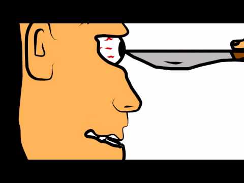 Guy gets eye stabbed out animation - YouTube