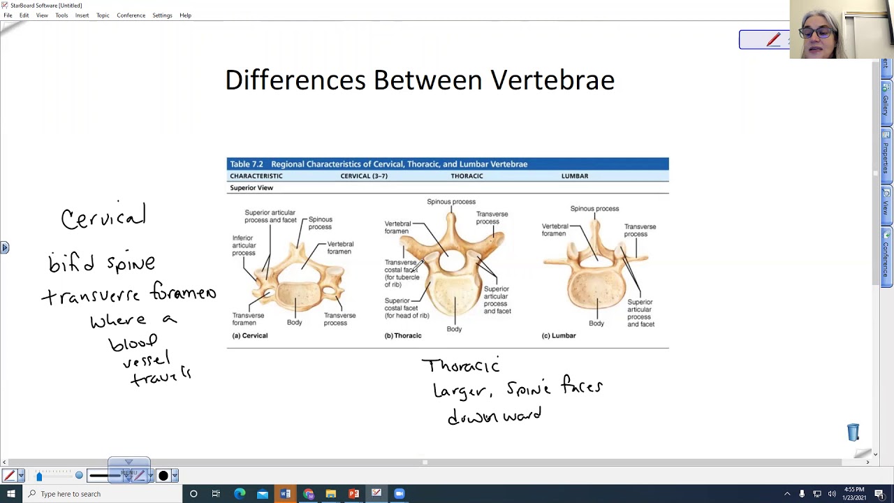 Comparison of Vertebrae Types - YouTube