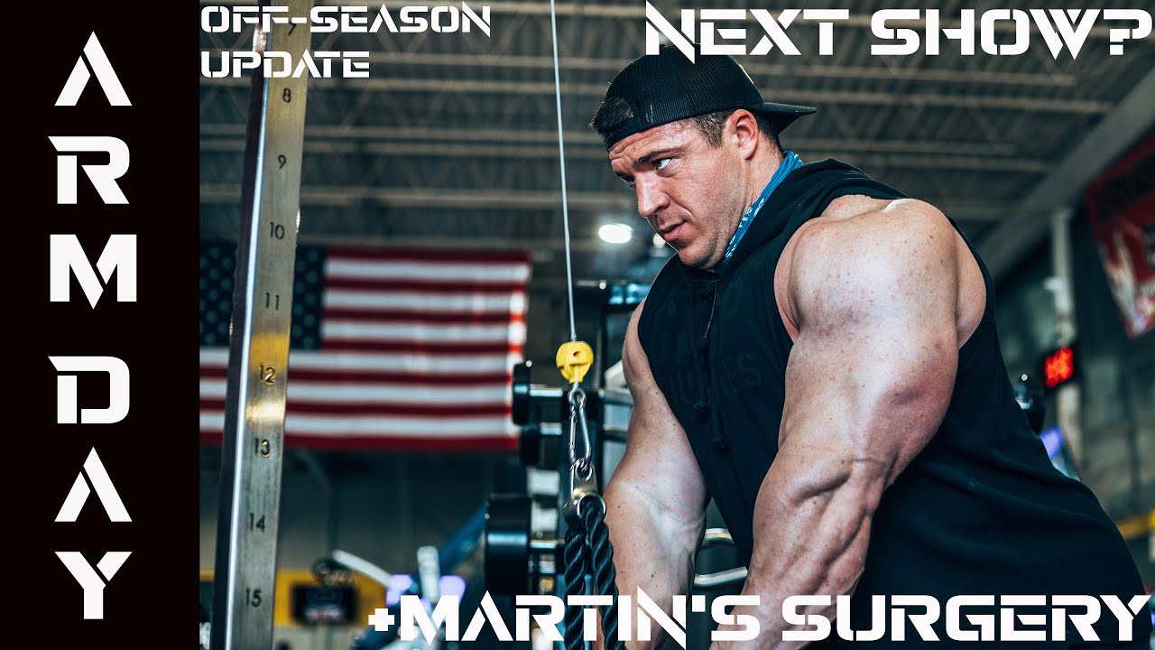 THE NEXT STEP: Martin's Recovery + SHOW CHOICES (FULL ARM DAY) - YouTube