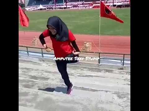 Hopping amputee - YouTube