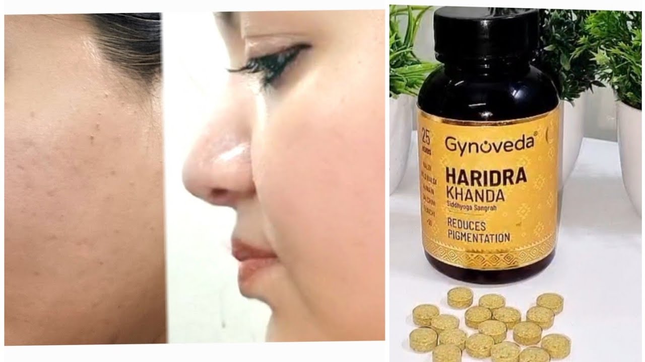 My skin journey with Gynoveda Haridra Khanda|Reduces pigmentation|100 ...