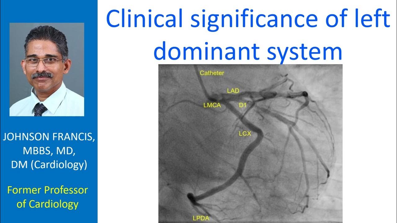 Clinical significance of left dominant system - YouTube