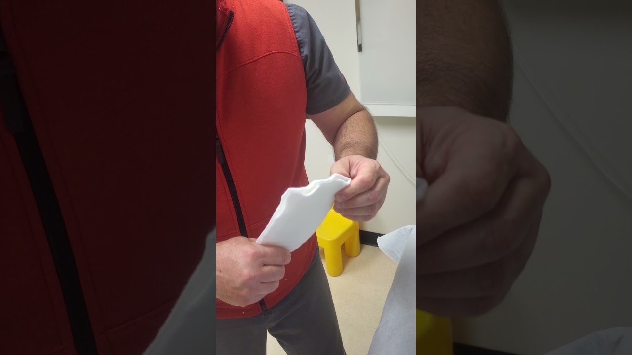 Thumb Spica Splint, Fiberglass, How to... - YouTube