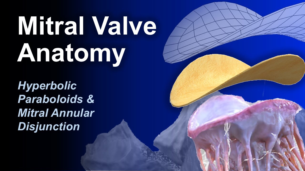 Mitral Valve Anatomy, Annular Disjunction & Hyperbolic Paraboloids ...