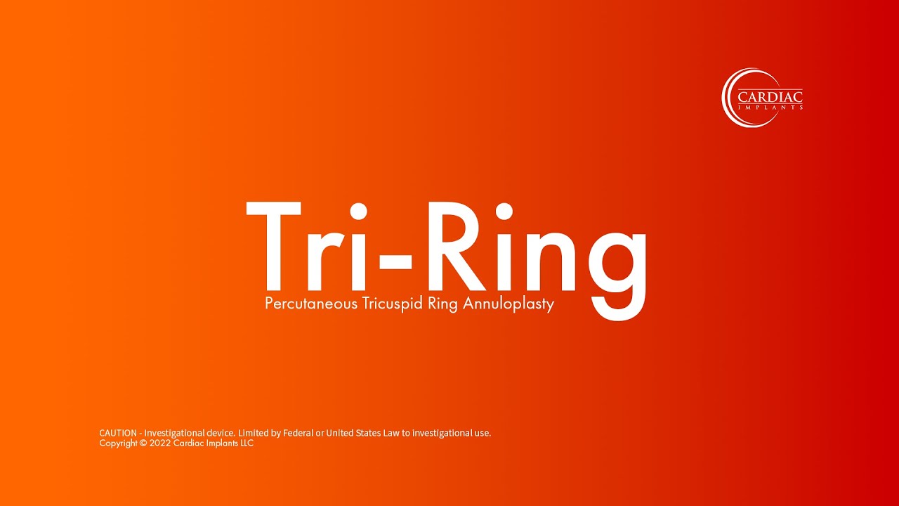 Cardiac Implants – Tri-Ring: Percutaneous Tricuspid Ring Annuloplasty ...