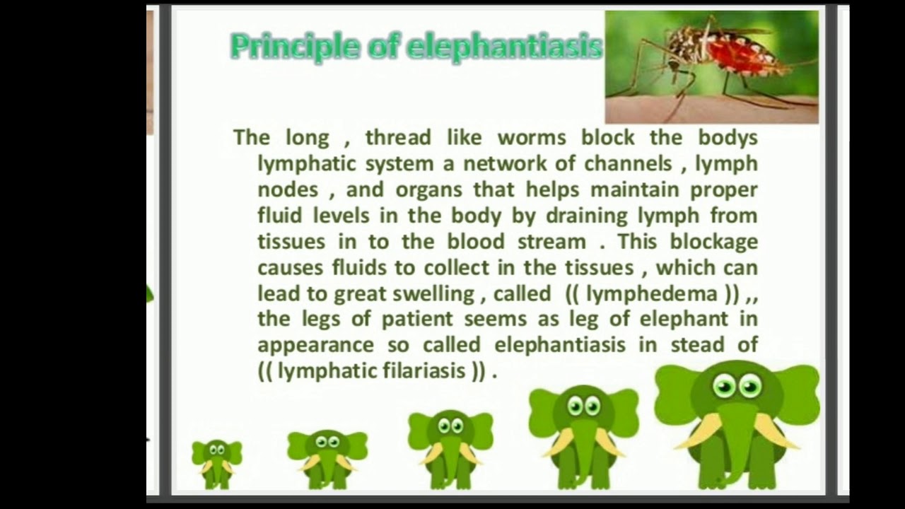 Elephantiasis (hathi pago) - YouTube