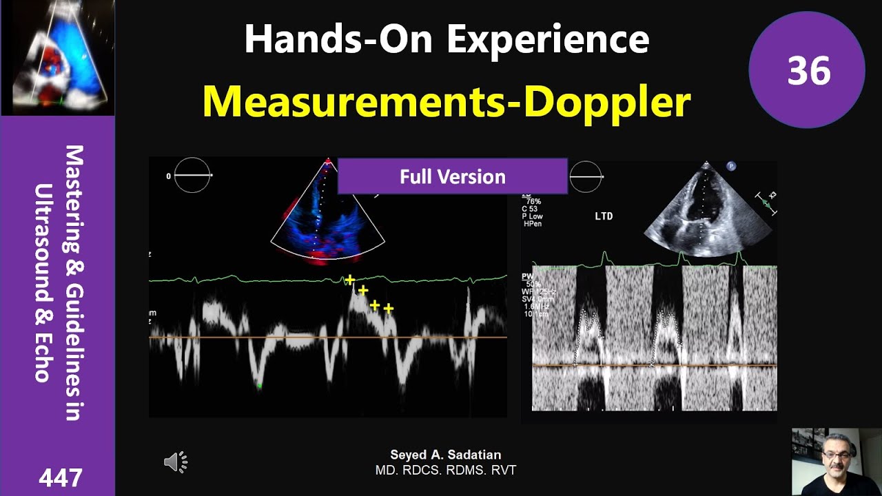 Hands-On Experience 36: Measurements-Doppler - YouTube
