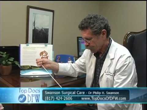 Dr. Philip Swanson Laparoscopic Gastric Binding 2 Top Docs of DFW - YouTube
