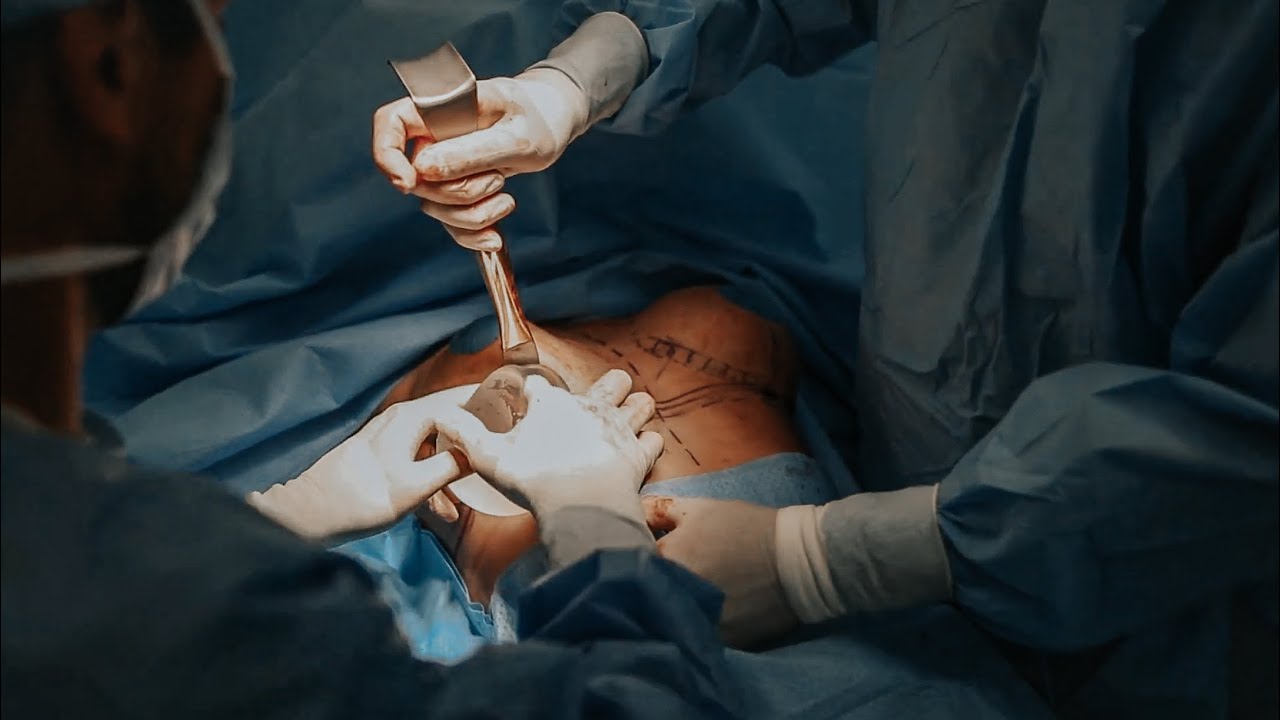 MOJA OPERACIJA- GRUDI! 🔥 (storytime,vlog,operacija) - YouTube