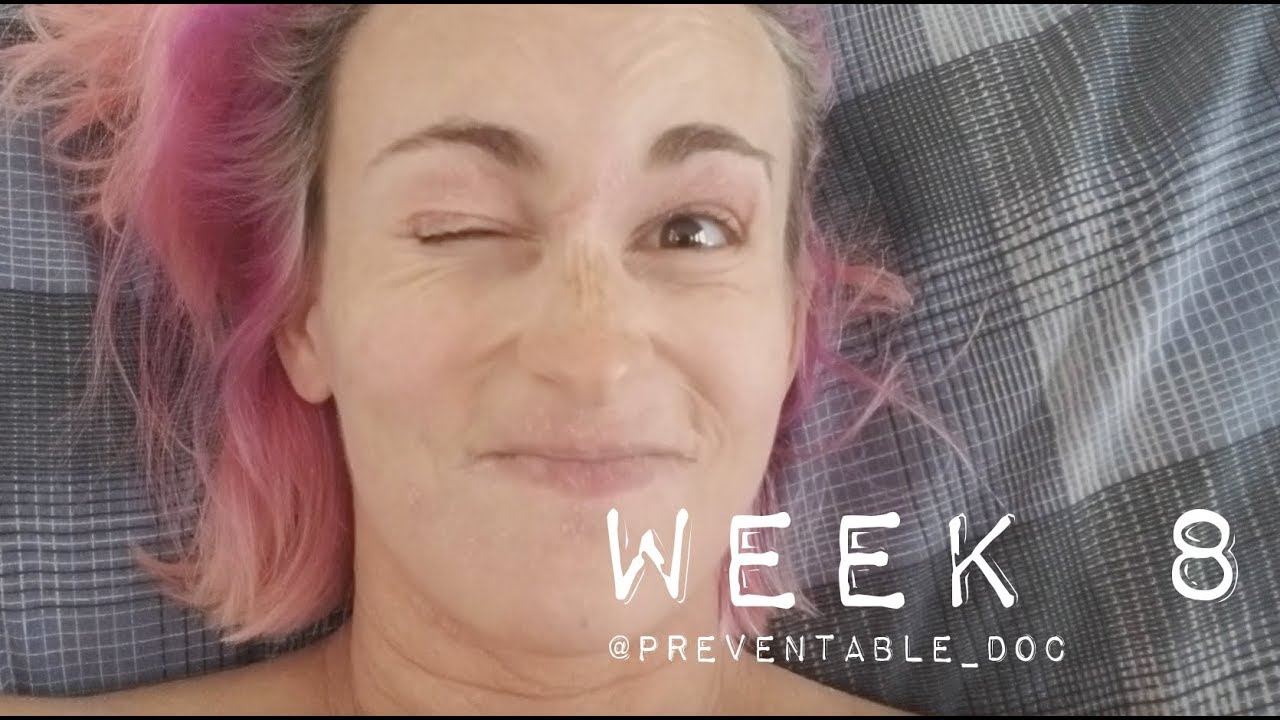 PREVENTABLE DOCUMENTARY: WEEK EIGHT (Red Skin Syndrome/TSW & Skin ...