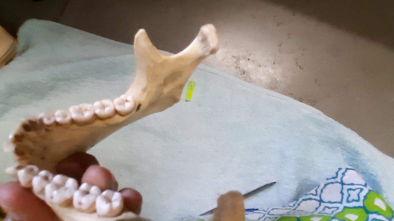 Mandible-- Demonstration - YouTube