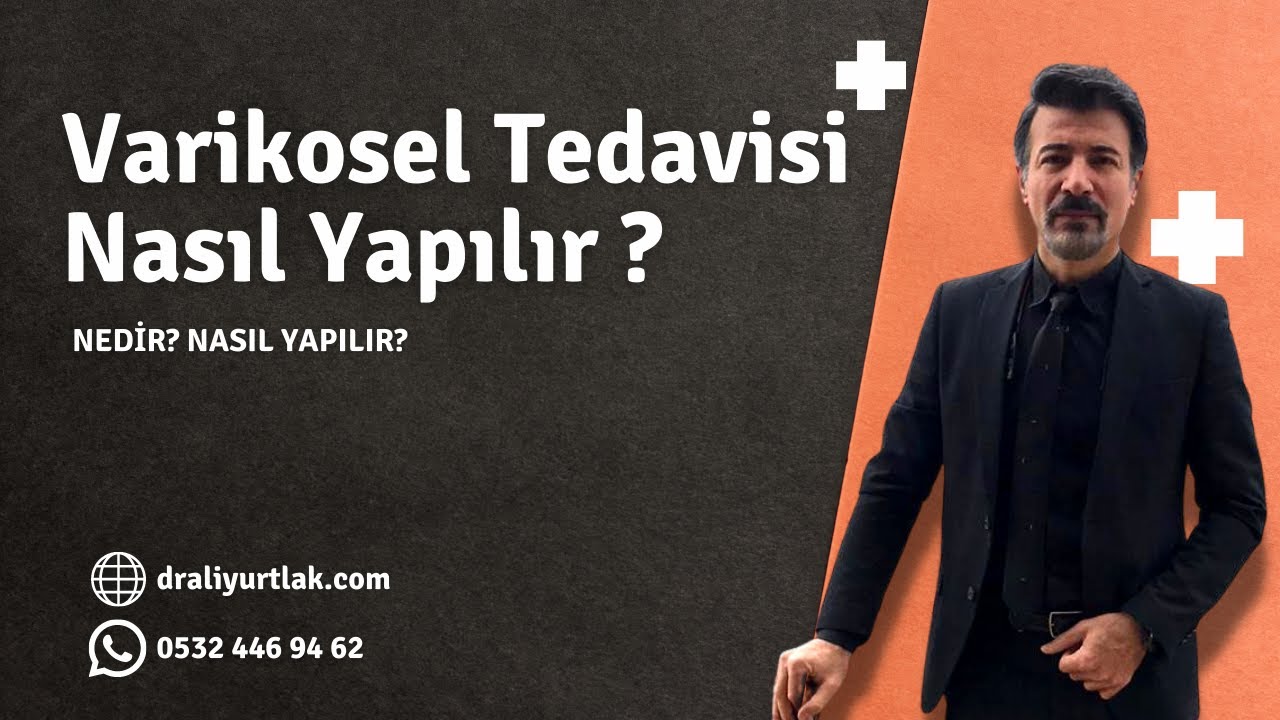 Varikosel Tedavisi Nasıl Yapılır ? - YouTube