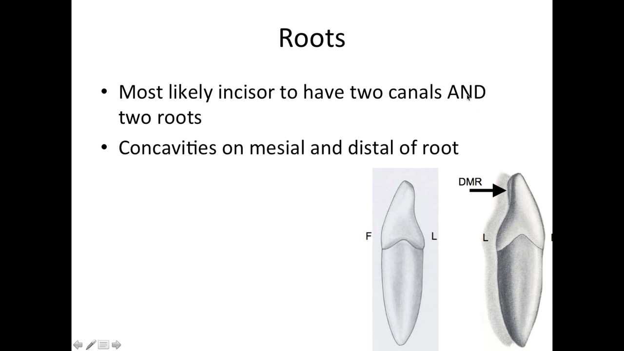 5 Mandibular Lateral Incisors - NBDE Part 1 Boards Study - YouTube
