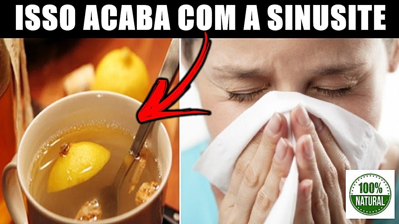 REMÉDIO CASEIRO NATURAL PARA SINUSITE - TRATAMENTO NATURAL PARA ...