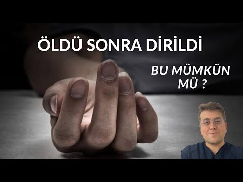 ÖLÜM SONRASI DİRİLME TIPTA MÜMKÜN MÜ ? LAZARUS FENOMENİ - ADLİ TIP UZMANI ANLATIYOR