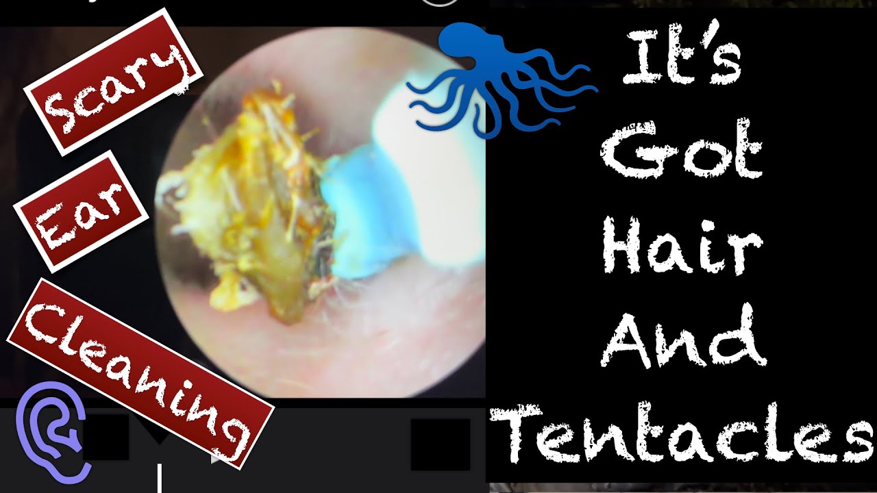 EARESISTABLE! Unearthing the Mythical Ear Monster 🧟‍♂️ | Satisfying Ear ...